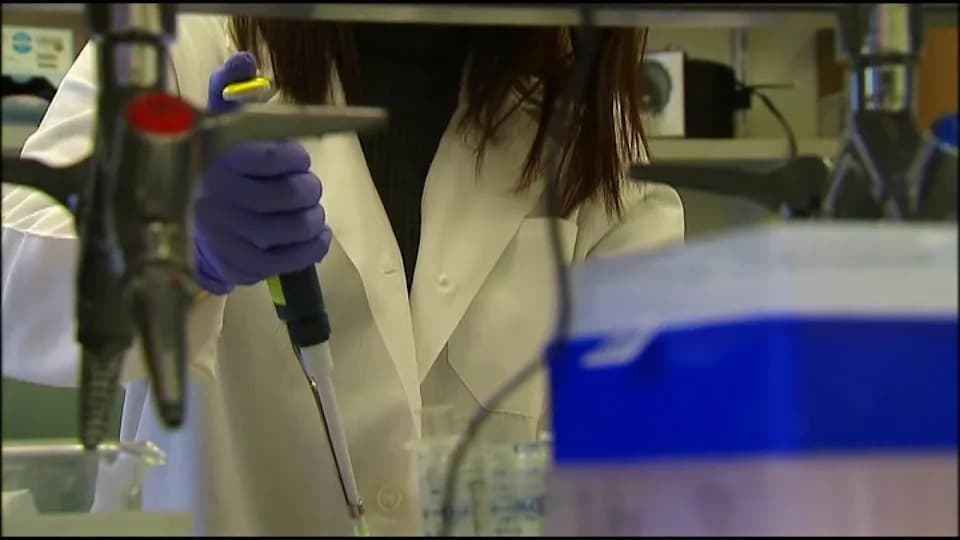 UCLA Study Links Estrogen Loss and X‑Chromosome Gene to Brain ...