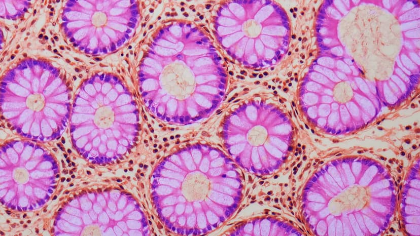 Hidden Epigenetic Warning in Gut Stem Cells Could Explain Rising ...